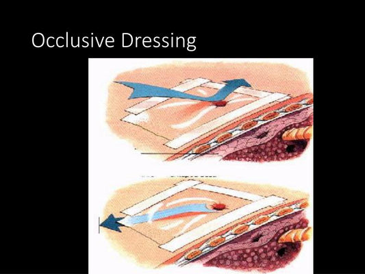 Flutter Valve (Occlusive Dressing) – The Paramedic Shop cc